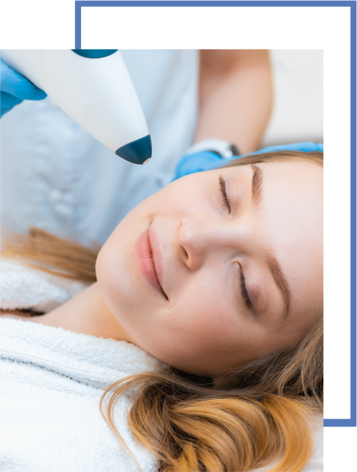 CooLifting | Tratamiento para rejuvenecer el rostro - Face Evidence